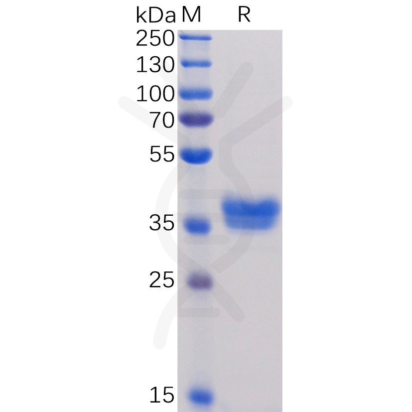 Membrane Protein Development Platform-DIMA BIOTECH