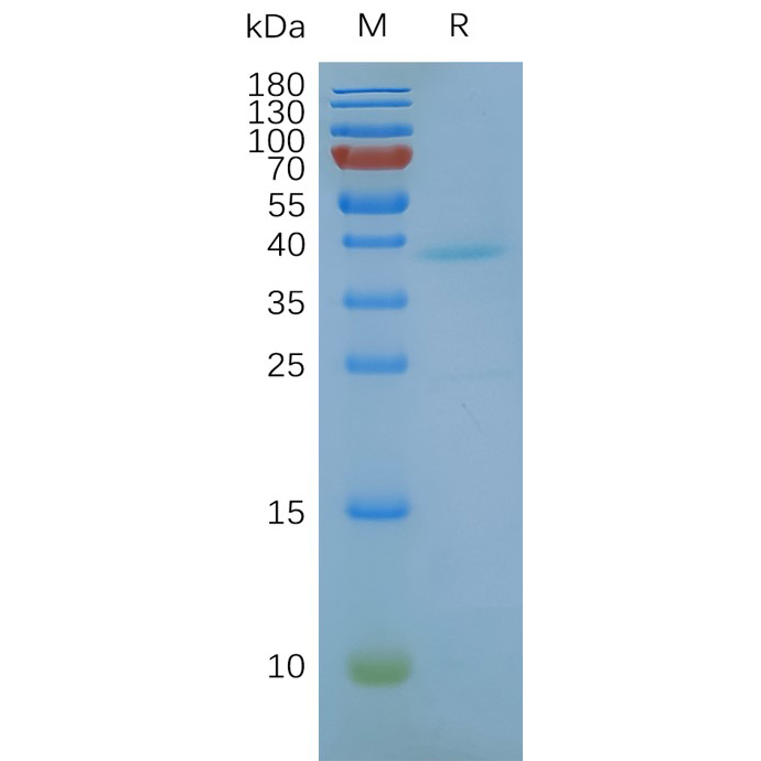 Human GPRC5D full length protein-synthetic nanodisc - DIMA Biotechnology