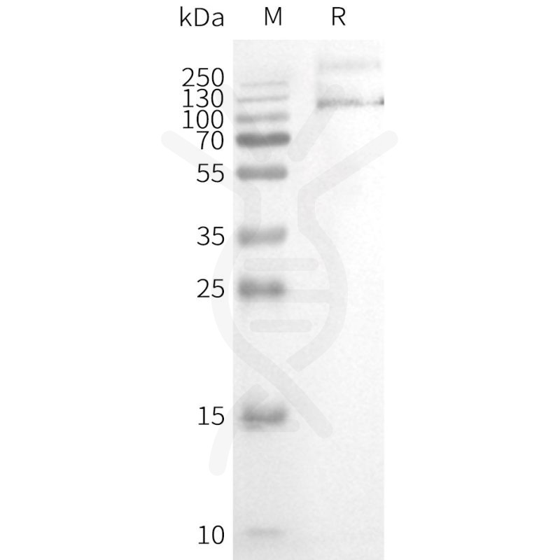 Human TRPV1 full length protein-synthetic nanodisc - DIMA Biotechnology
