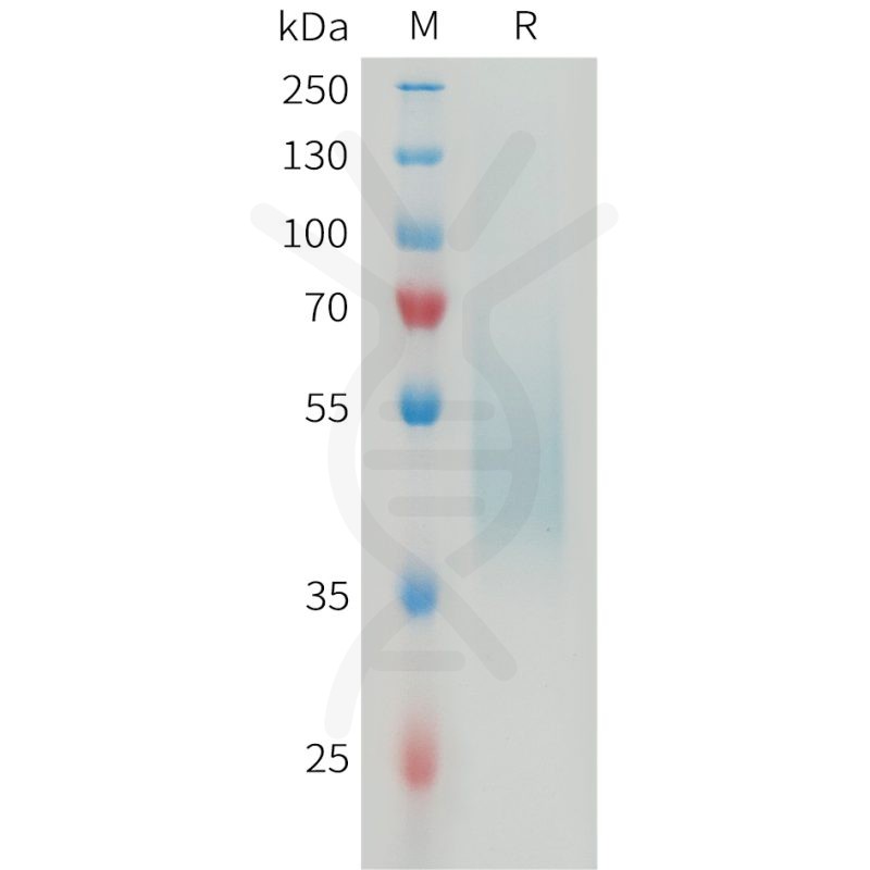 Mouse B7-H4 Protein, His Tag - DIMA Biotechnology