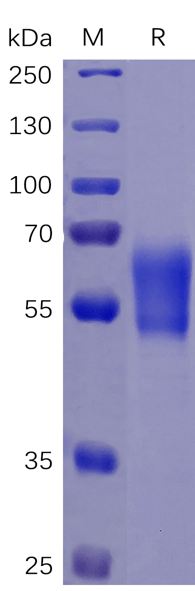 Human PD-1 Protein, hFc-His tag - DIMA Biotechnology