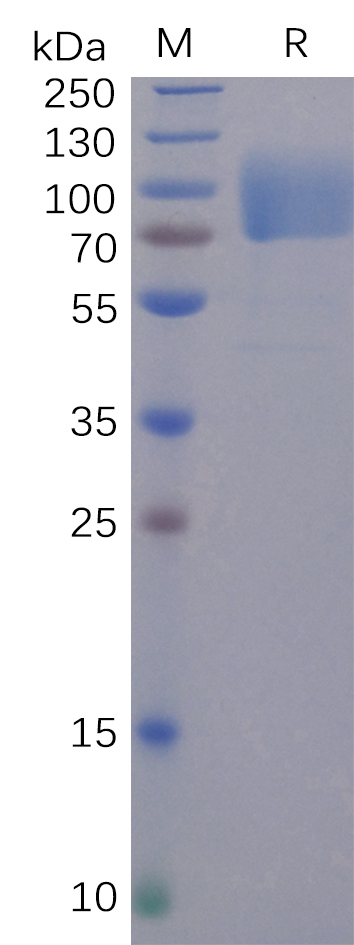 SARS-CoV-2 (2019-nCoV) S1 protein NTD, hFc Tag - DIMA Biotechnology