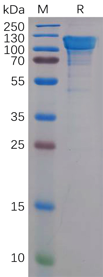 Human APP Protein, His Tag - DIMA Biotechnology