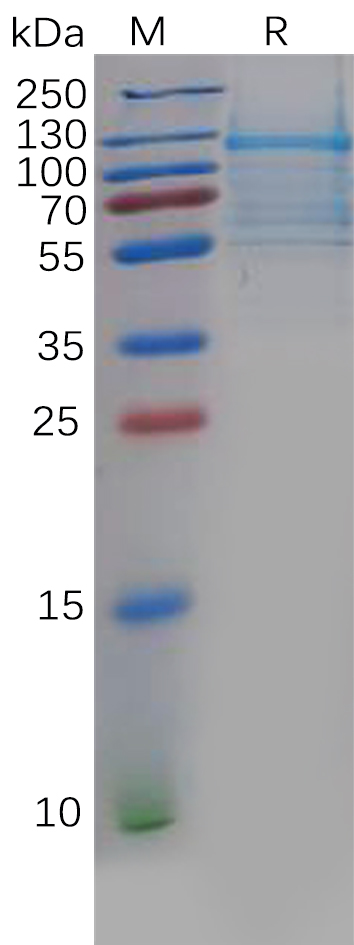 Human DLL3 Protein, hFc Tag - DIMA Biotechnology