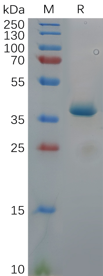 Human ROR1 (312-391) Protein, hFc Tag - DIMA Biotechnology