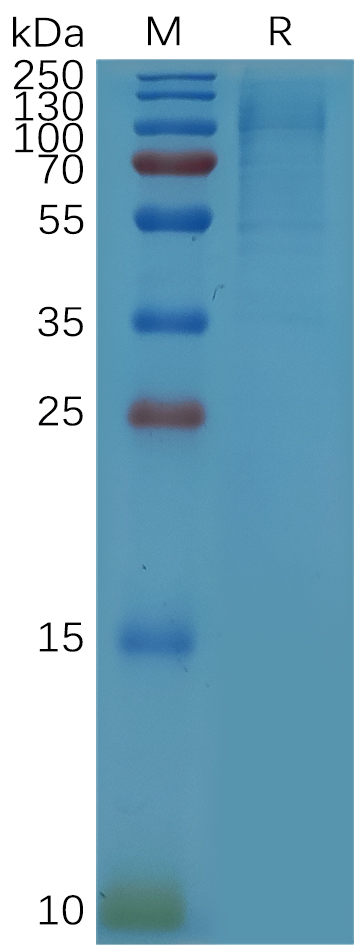 Human TIM1 Protein, His Tag - DIMA Biotechnology