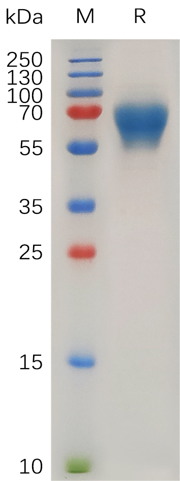 Human LIF Protein, hFc Tag - DIMA Biotechnology