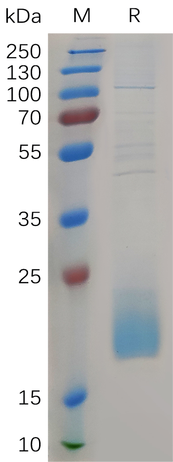 Human CD3D Protein, His Tag - DIMA Biotechnology
