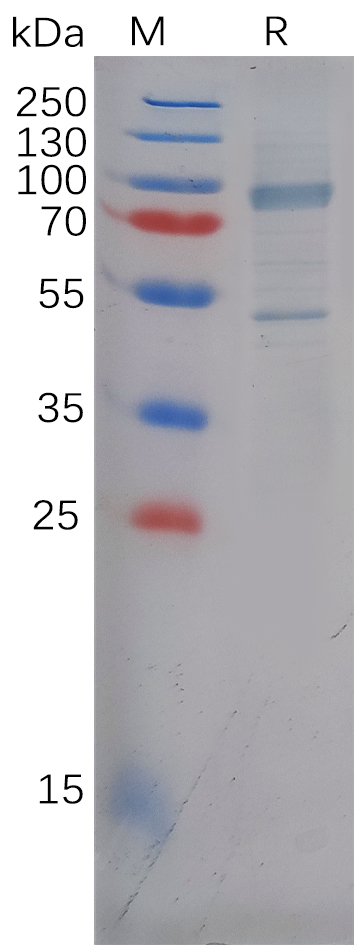 Human CDH3 Protein, His Tag - DIMA Biotechnology