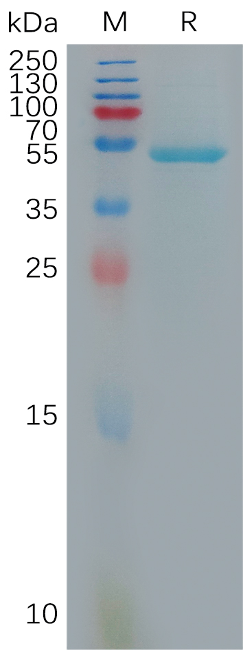 Human IL10 Protein, hFc Tag - DIMA Biotechnology