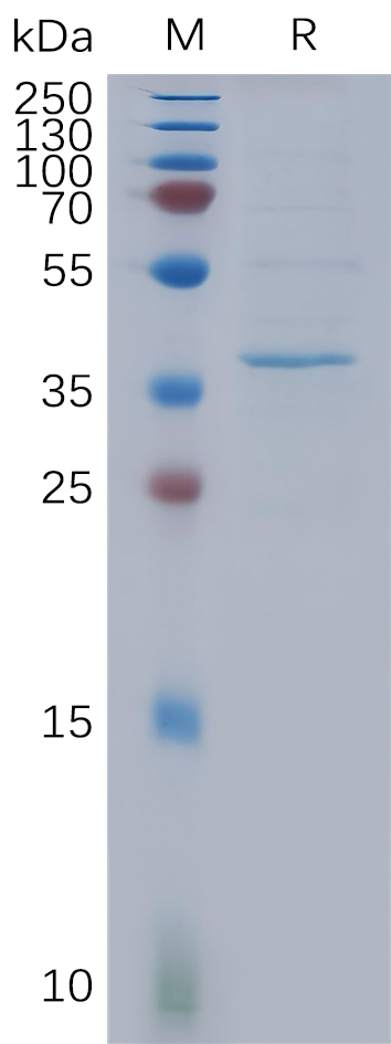 Human HSD17B13 Protein, Flag Tag - DIMA Biotechnology