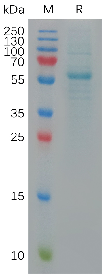 SARS-CoV-2 (Omicron BA.5) S protein RBD, hFc Tag - DIMA Biotechnology
