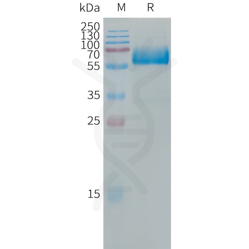 Human LOX-1 Protein, hFc Tag - DIMA Biotechnology
