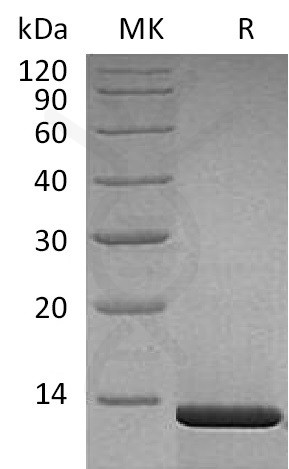 Human Beta-NGF (Mammalian) Protein - DIMA Biotechnology