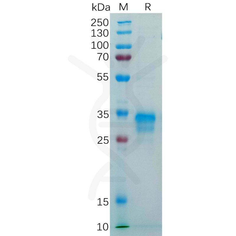 Human FOLR1 Protein, His Tag - DIMA Biotechnology