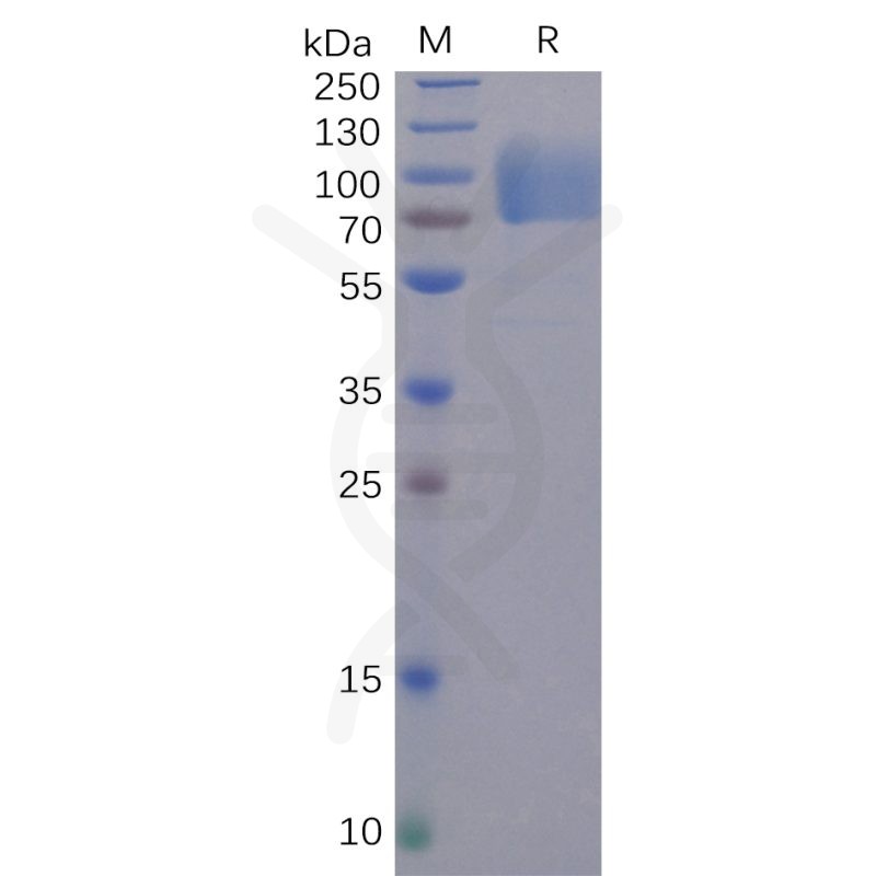 Buy SARS-CoV-2 (2019-nCoV) S1 protein NTD, hFc Tag-S1 protein NTD ...
