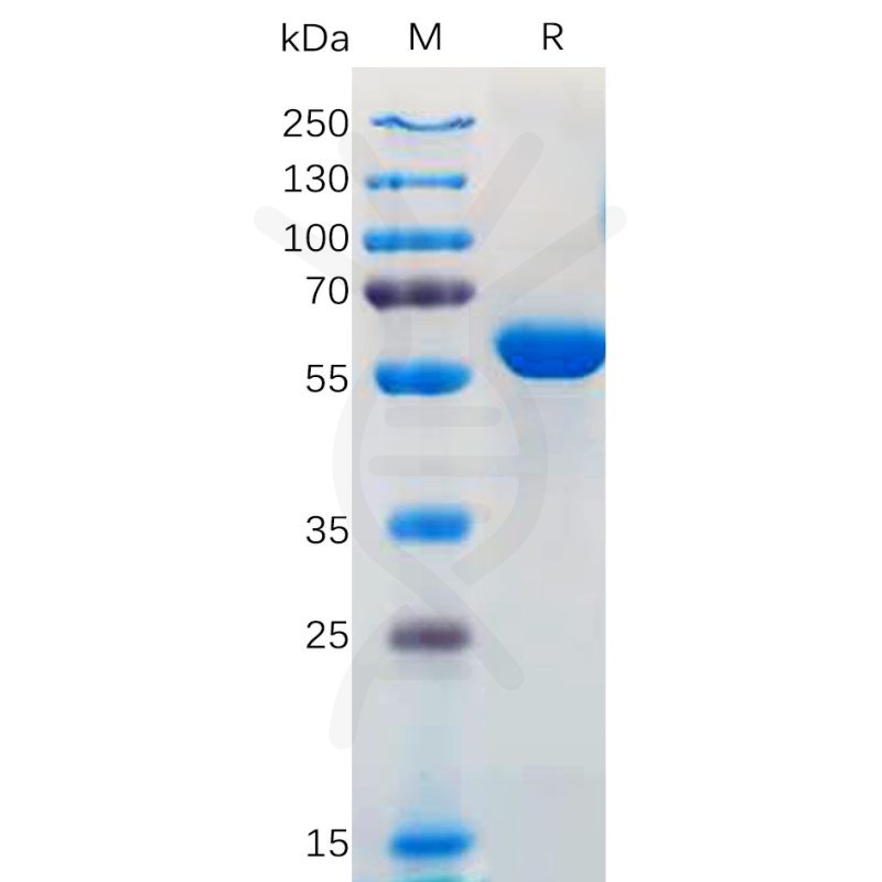 Buy SARS-CoV-2 (Kappa) nCoV S Protein RBD Protein, hFc Tag-S protein ...